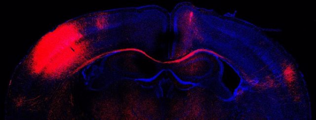 Investigadores del CSIC identifican la implicación de un tipo ... Investigadores del CSIC identifican la implicación de un tipo ...